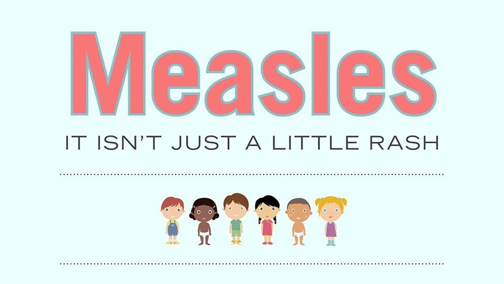 Concern grows amid global measles resurgence...