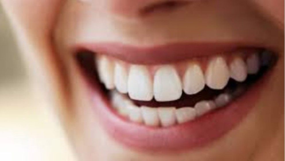 Secrets to Whitening Teeth at Home with Simple Ingredients: A ...