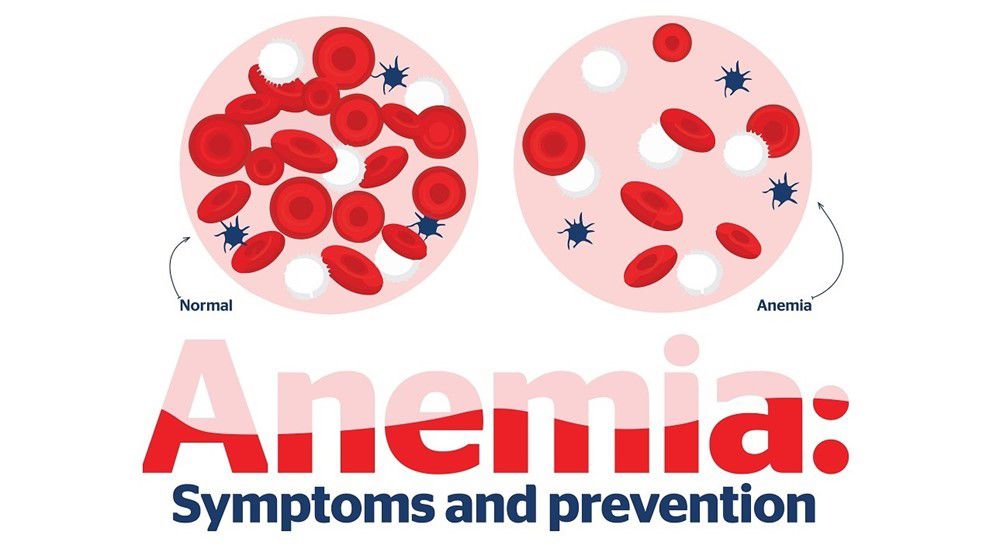 Anemia : Symptoms and prevention...