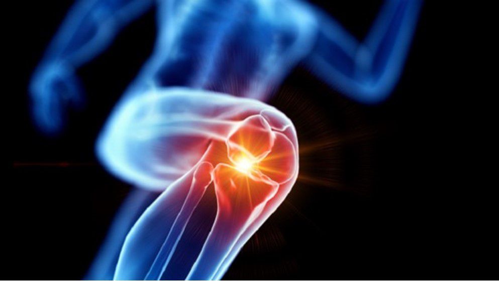 5 Effective Solutions to Reduce Knee Cracking...